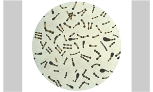 NEISSER'S METACHROMATIC STAINS KIT | Staining Kit | Article No. K0007