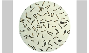 NEISSER'S STAIN C | Staining Solutions | Article No. 04817